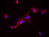 MOC22 Mouse Oral Squamous Cell Carcinoma (OSCC) Cell Line | SCC471